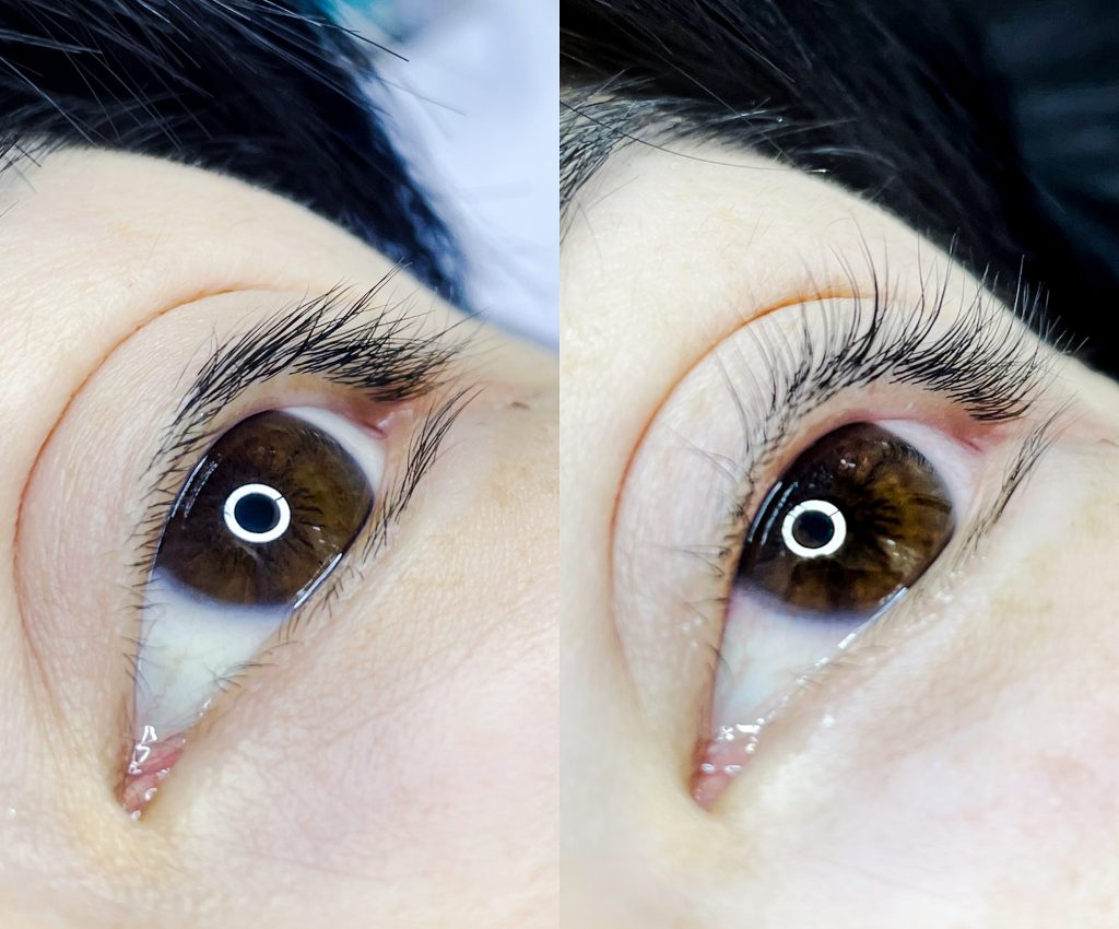 InLei® Forma PLATINUM SILICONE SHIELDS 4 PAIRS - InLei® South Africa